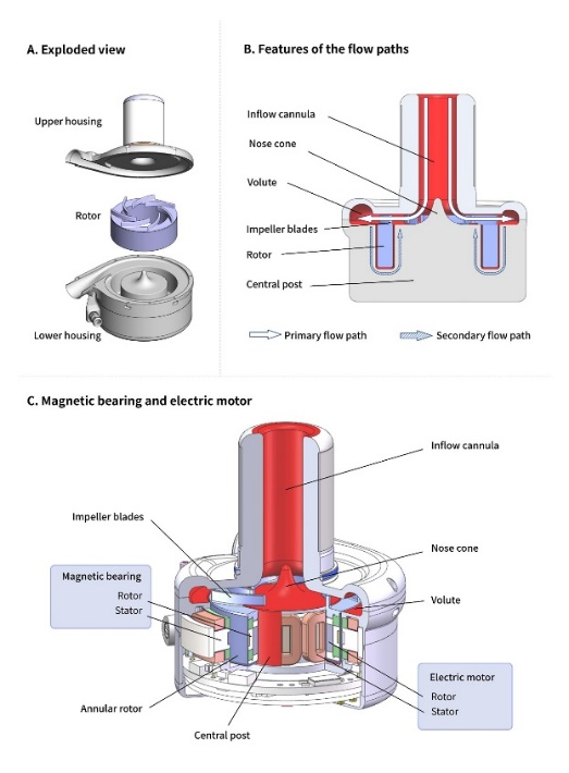 全磁悬浮心室辅助装置CH-VAD长期结果在国际心胸外科顶尖医学期刊发表